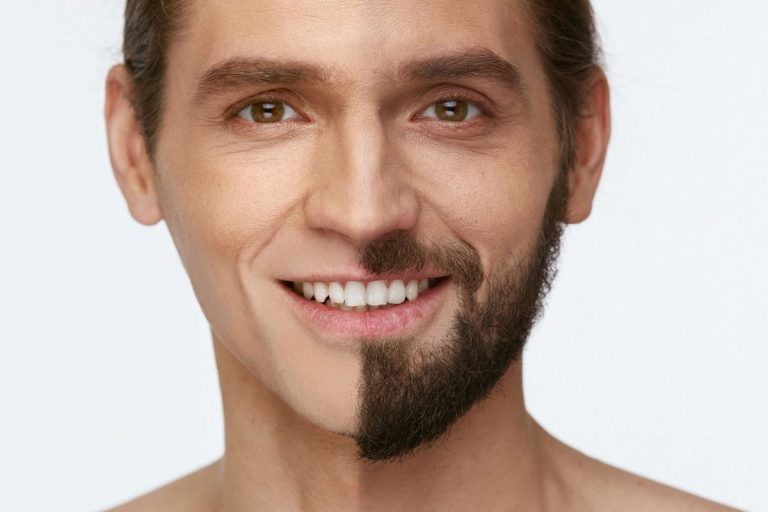 How To Turn Peach Fuzz Into A Beard - Beards Base
