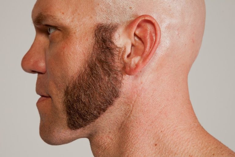 How To Grow Mutton Chop Side Burns - Beards Base
